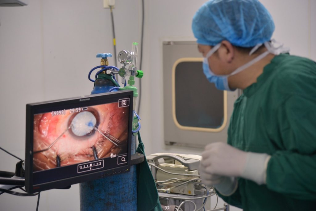 What to Expect Before, During, and After Cataract Surgery ~ Cool Things ...